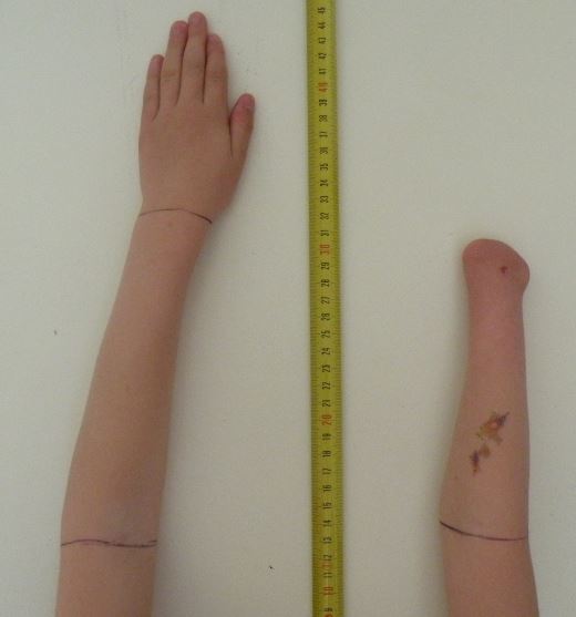 Un Bras pour un Enfant – Team Gre-Nable