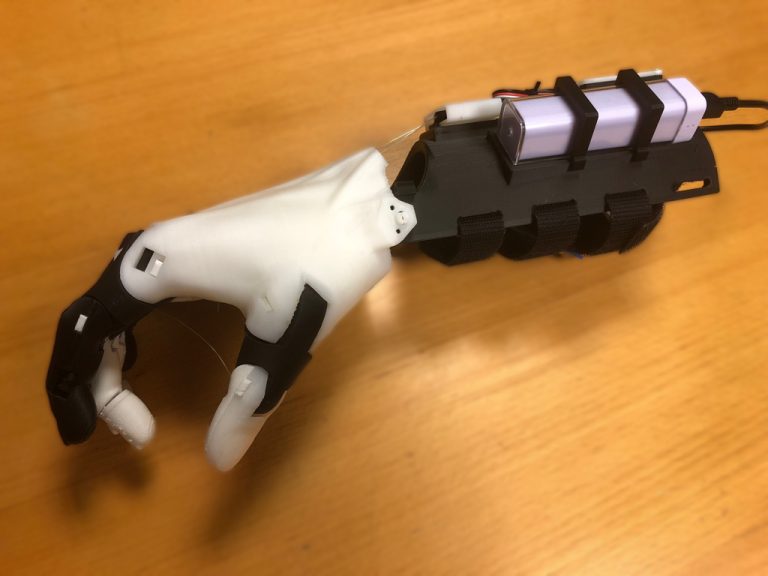 Prosthesis Archives – Team Gre-Nable